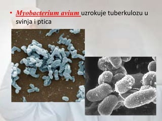Tuberkuloza-Tuberculosis | PPTX