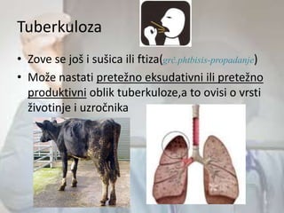 Tuberkuloza-Tuberculosis | PPTX