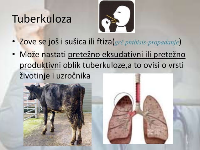 Tuberkuloza-Tuberculosis | PPTX