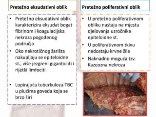 Tuberkuloza-Tuberculosis | PPTX