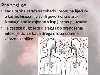 Tuberkuloza-Tuberculosis | PPTX
