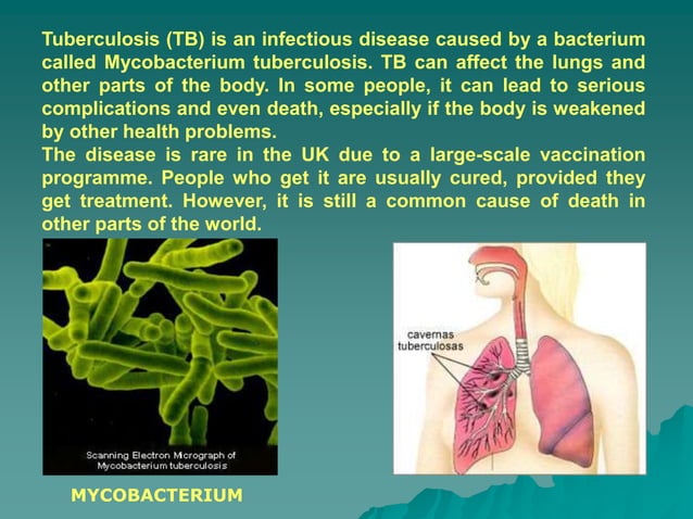 Tuberosis presentation1 | PPSX | Lung and Respiratory Health | Diseases ...