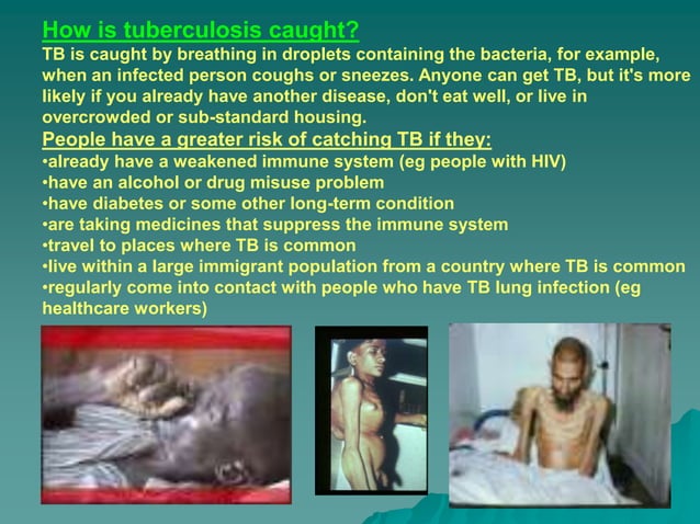 Tuberosis presentation1 | PPSX | Lung and Respiratory Health | Diseases ...