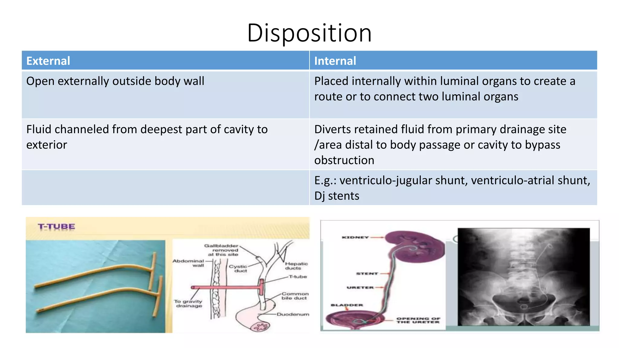 Tubes and drains | PPTX