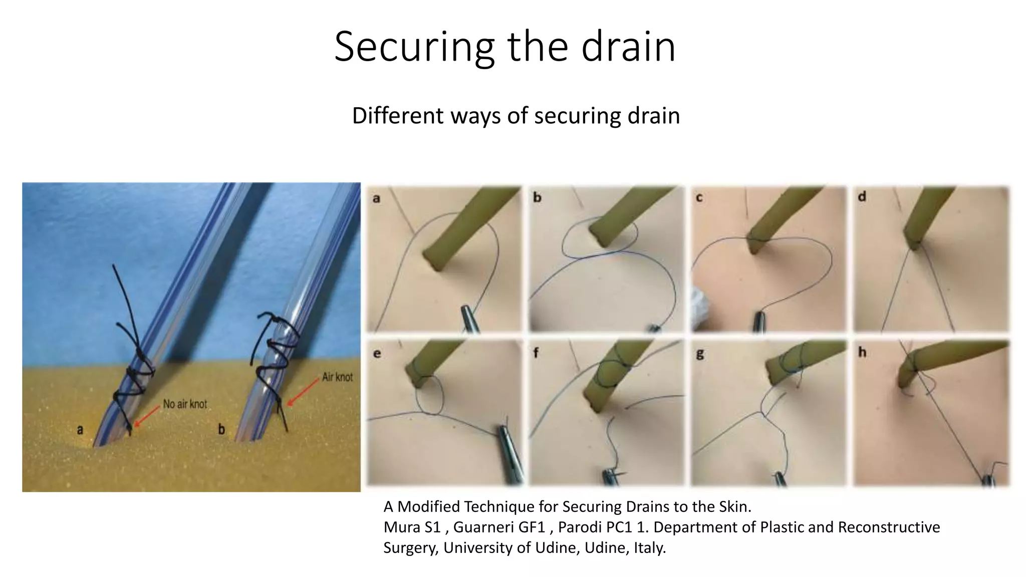 Tubes and drains | PPTX