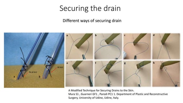 Tubes and drains | PPTX