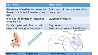 Tubes and drains | PPTX