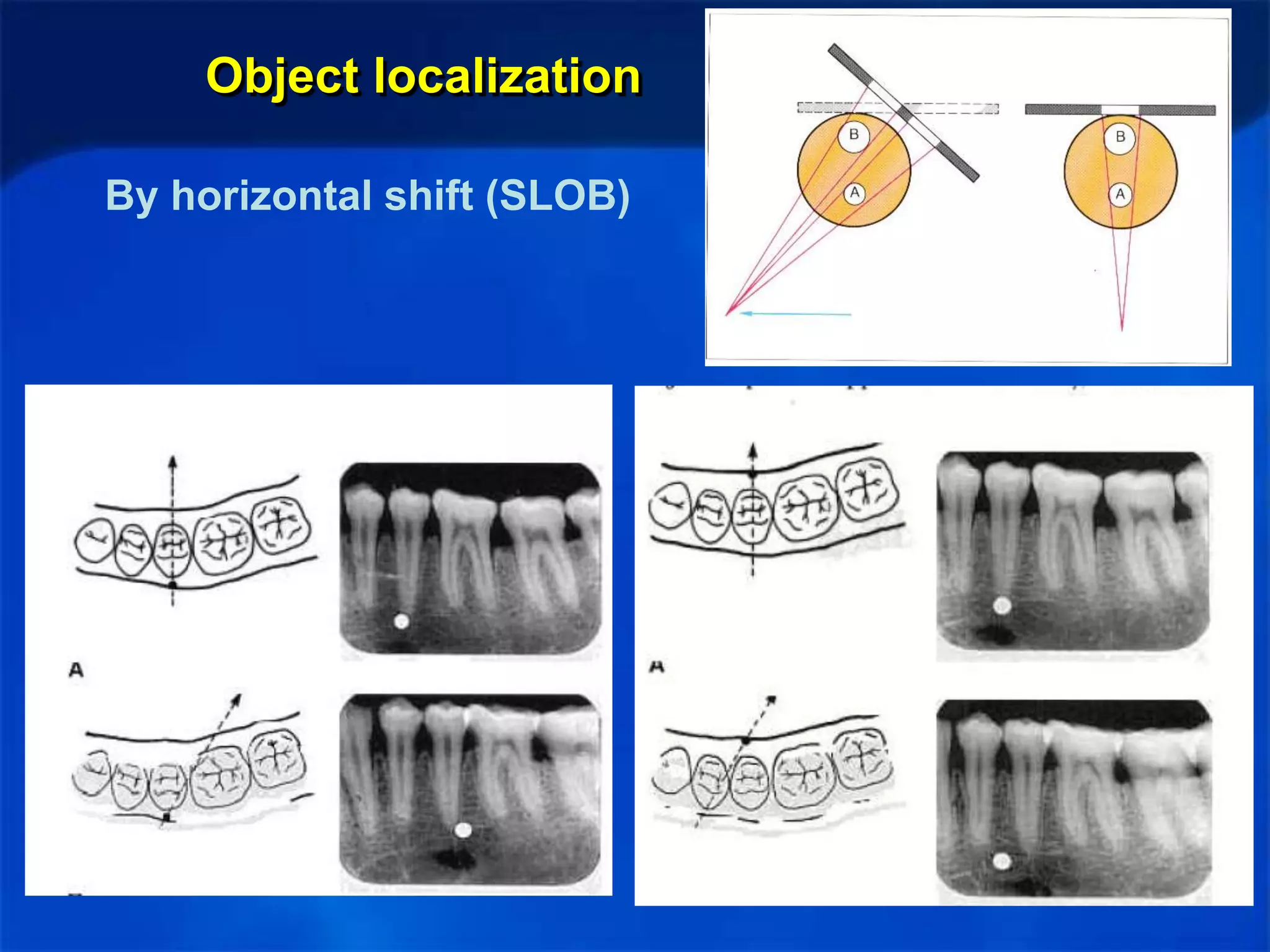 Tube Shift Technique | PPSX