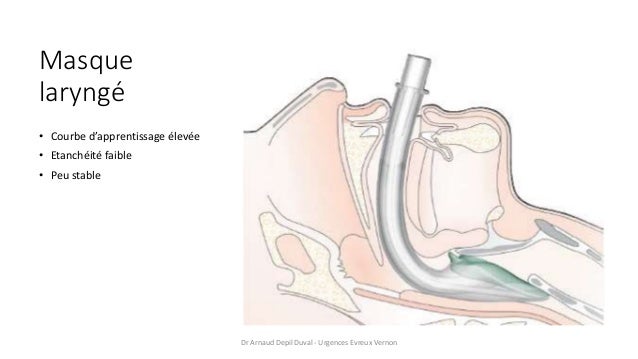 Tubes laryngés lts d