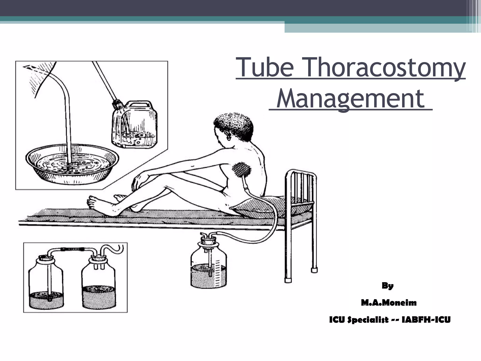 Tube Thoracostomy, Management | PPT