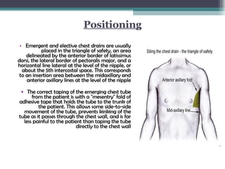 Tube Thoracostomy, Management | PPT