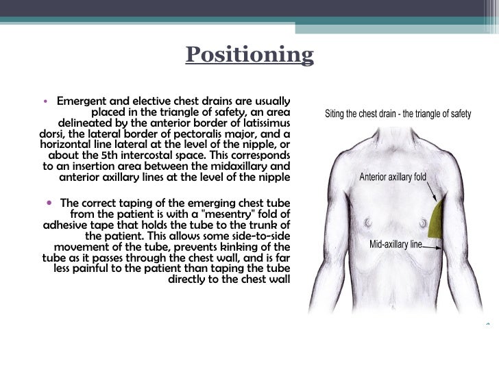 Tube Thoracostomy, Management