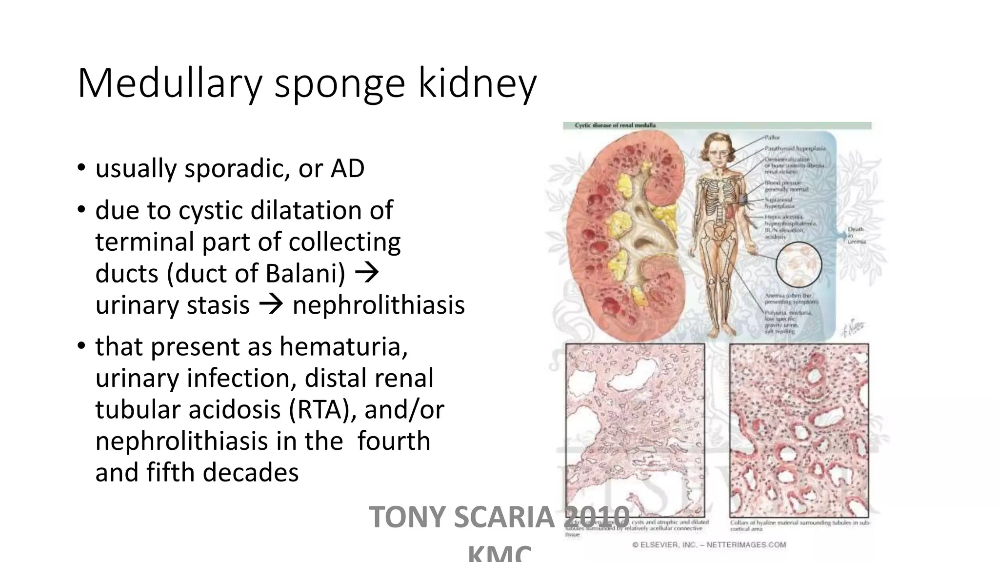 Tubular disorders of kidney REVISION NOTES | PDF