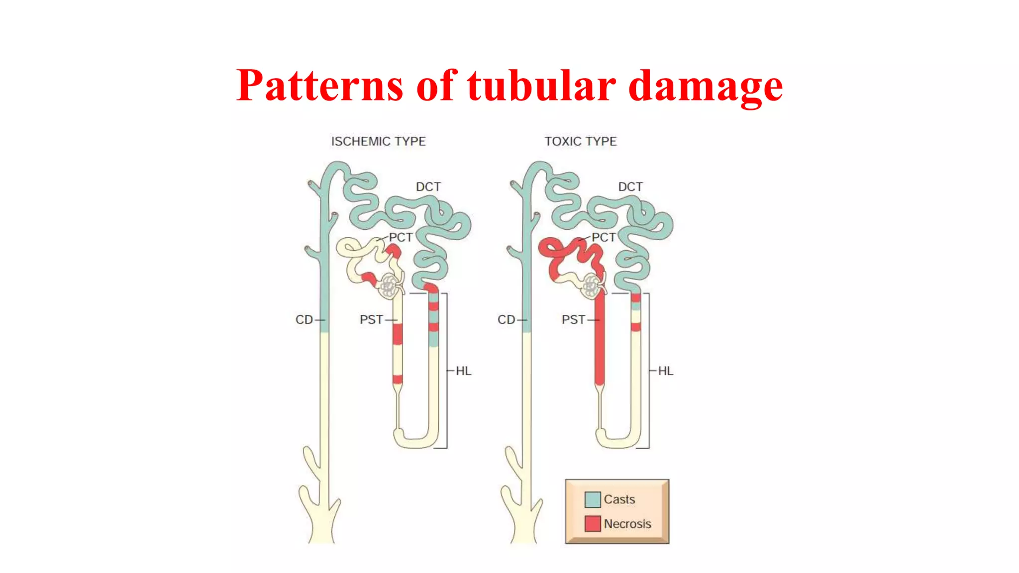 Tubulointerstitial diseases | PPTX