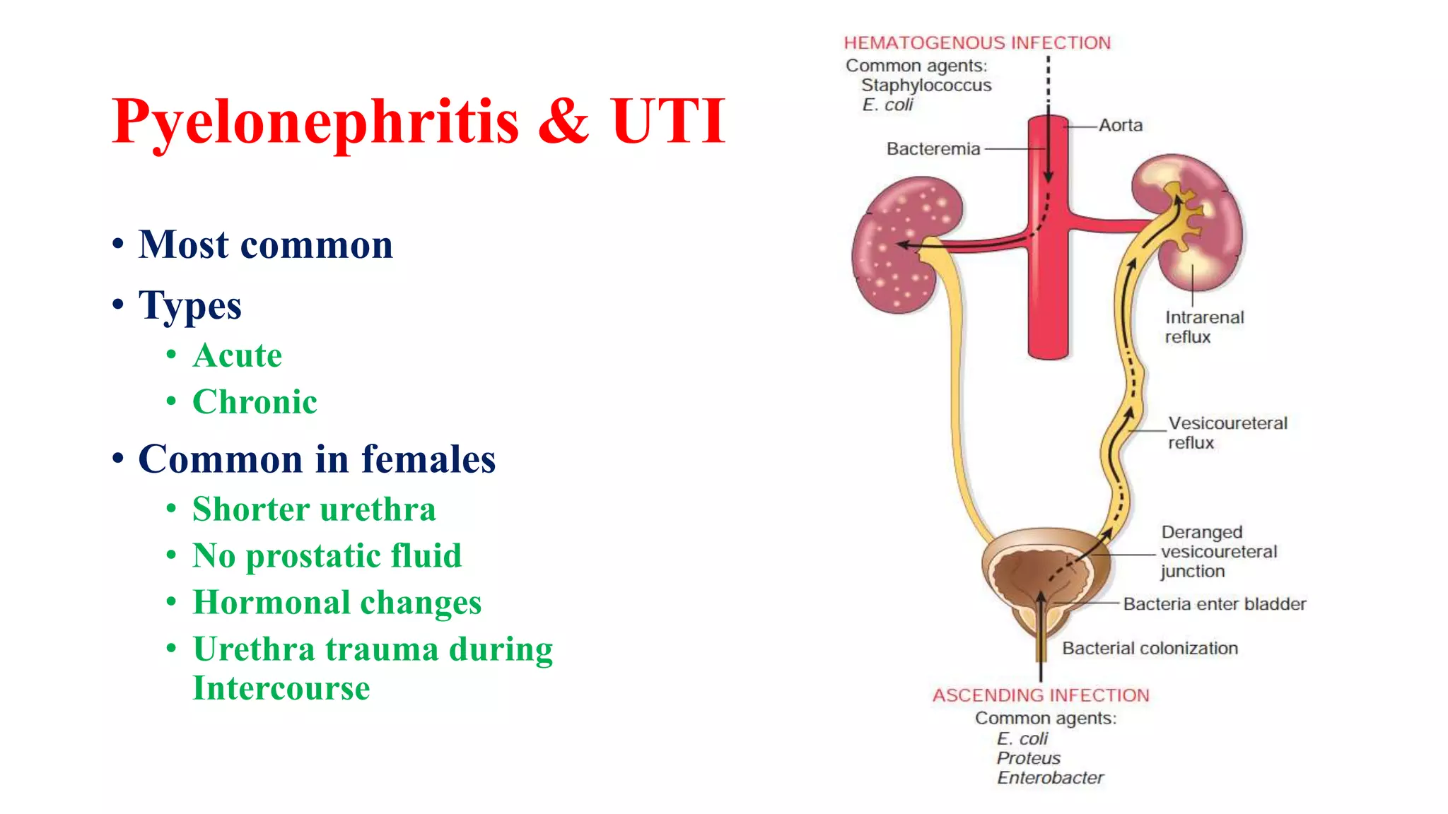 Tubulointerstitial diseases | PPTX