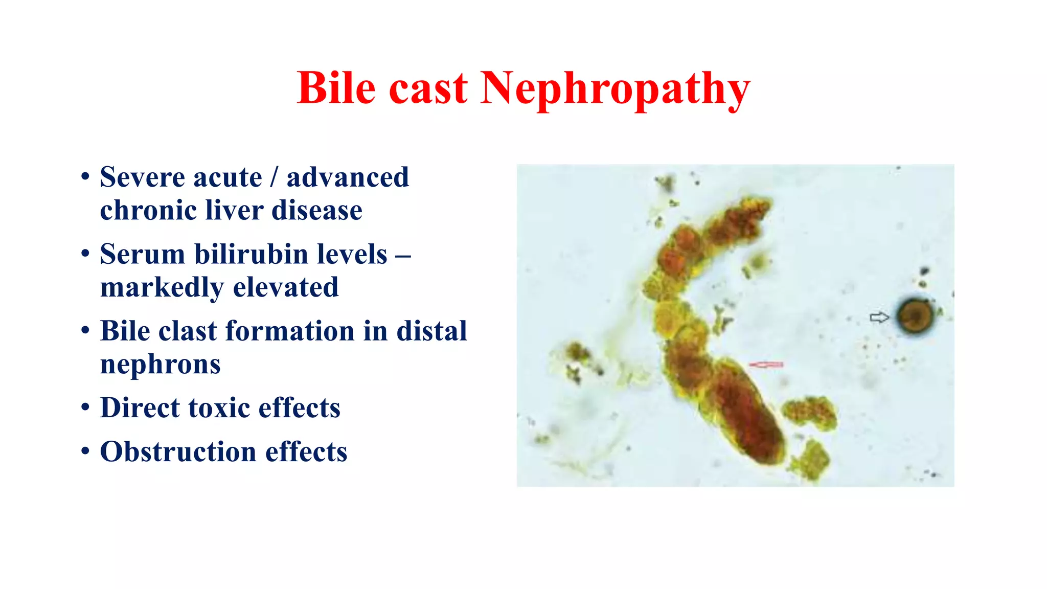Tubulointerstitial diseases | PPTX