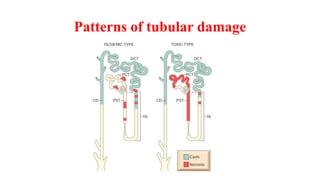 Tubulointerstitial diseases | PPTX