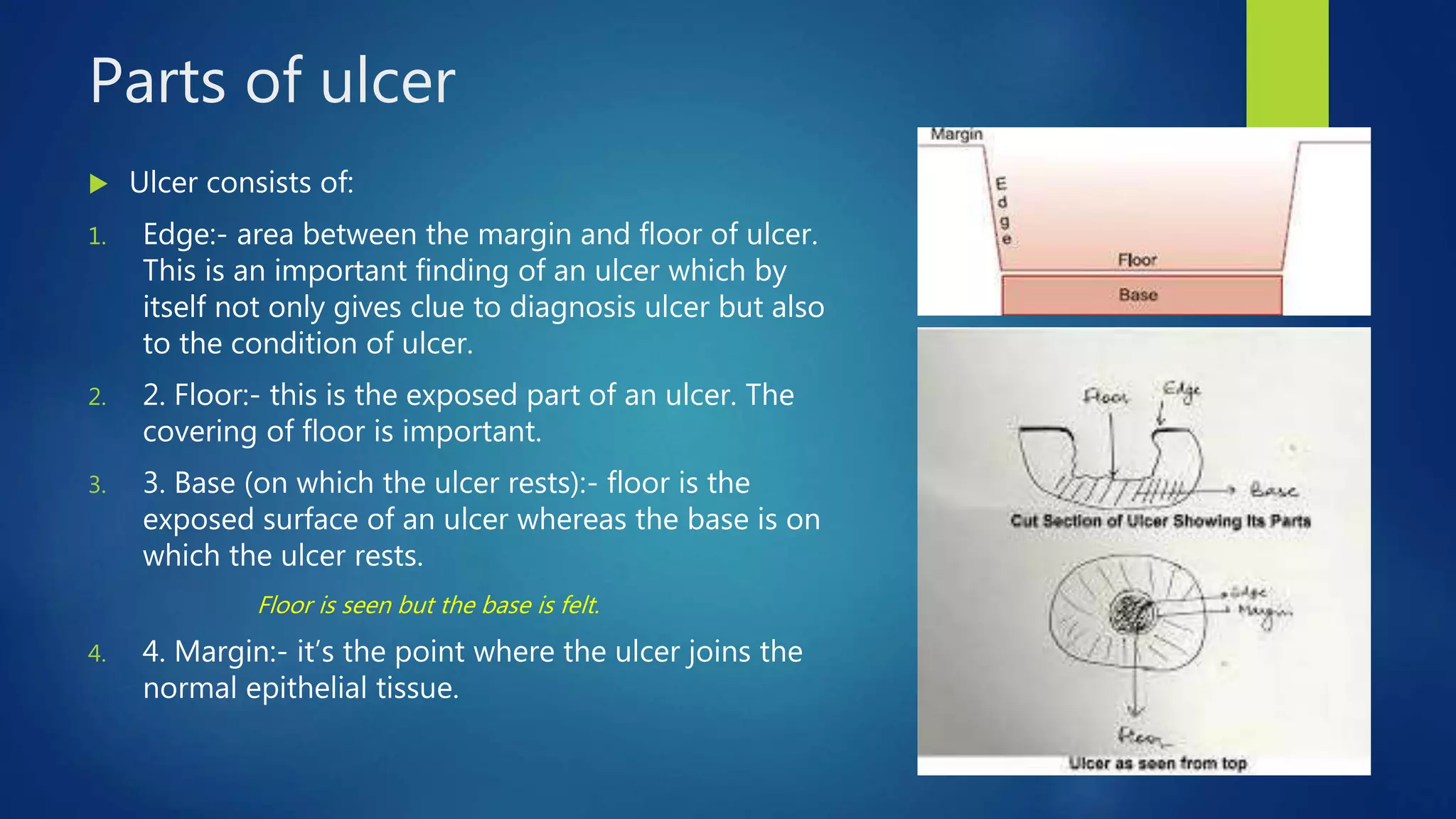 Tumor,ulcer,cyst,sinus,fistula.pptx