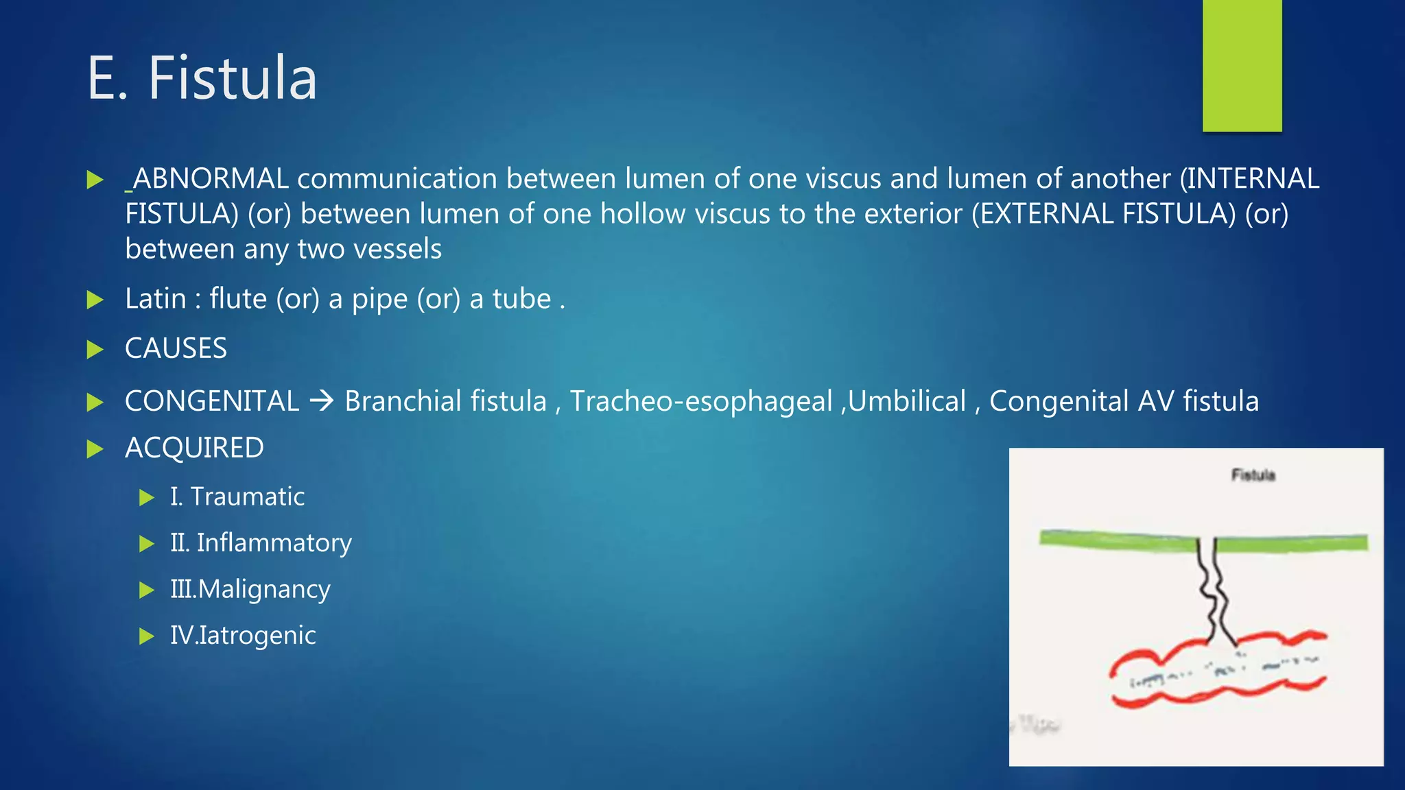 Tumor,ulcer,cyst,sinus,fistula.pptx