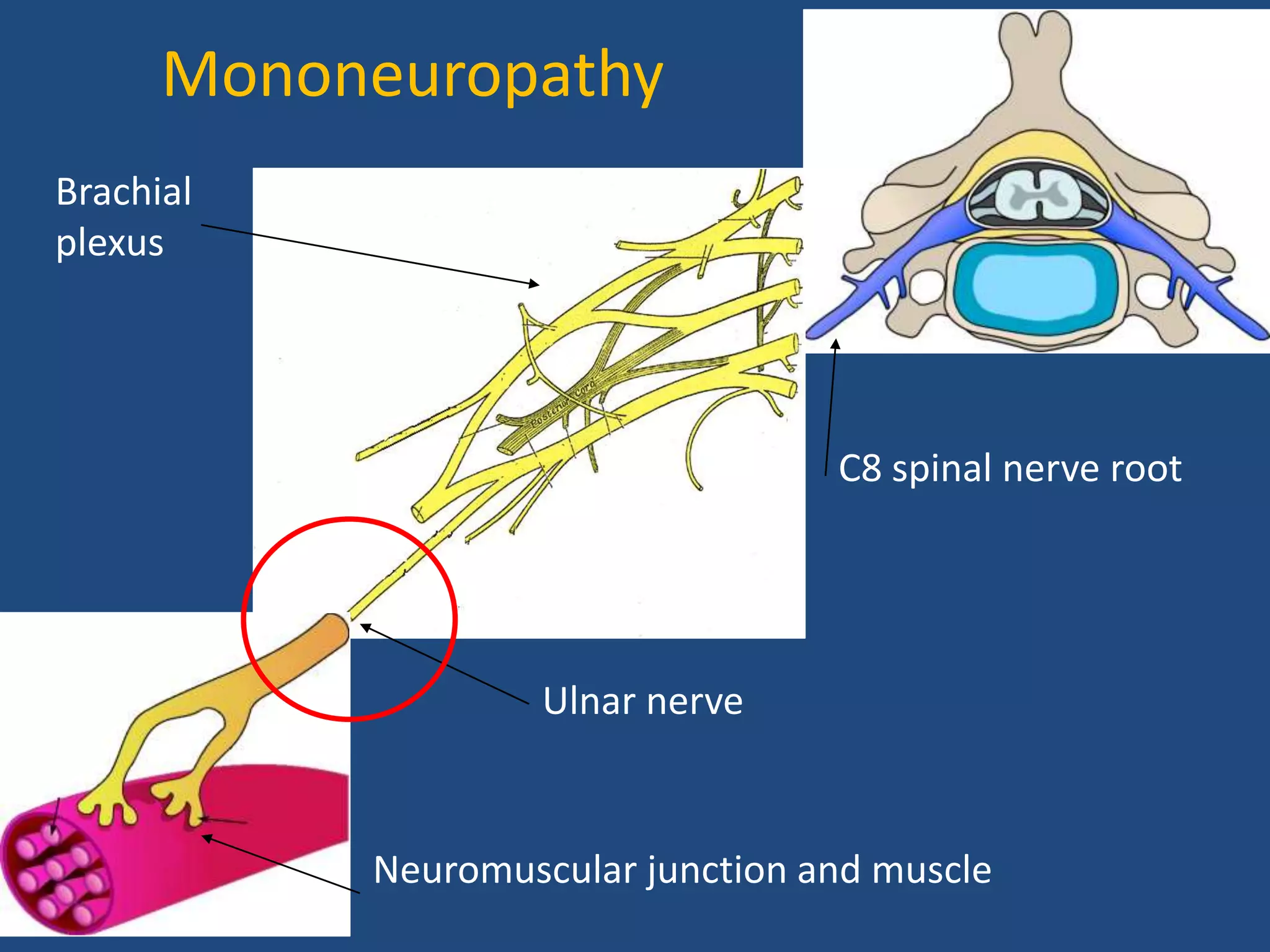 Tues 10 20 peripheral nerve disorders- a practical overview | PPT