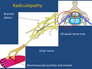 Tues 10-20 Peripheral Nerve Disorders444- A Practical Overview 222.pptx