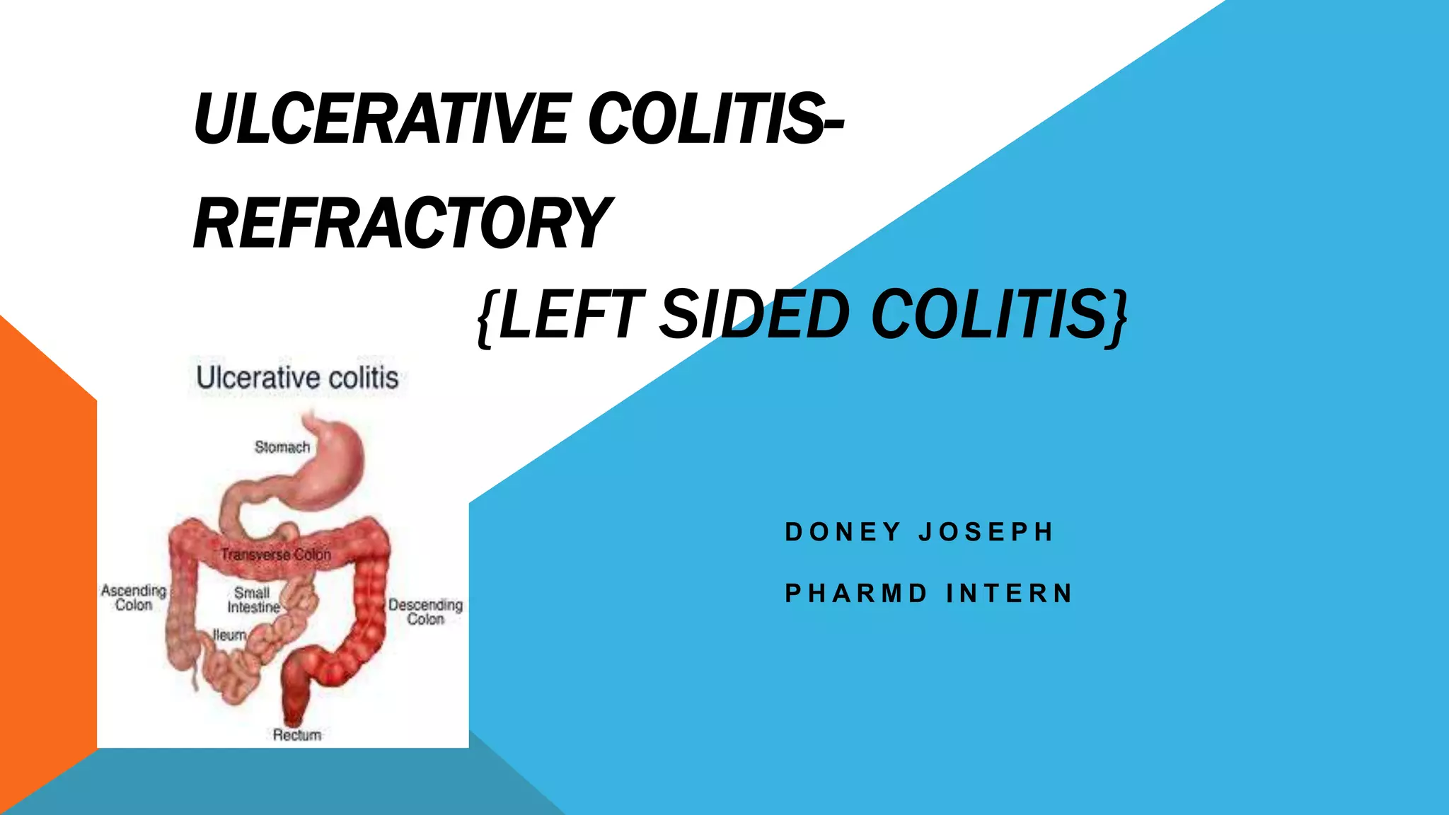 Ulcerative Colitis | PPT
