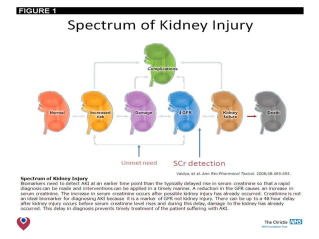 AKI (Acute Kidney Injury) | PDF
