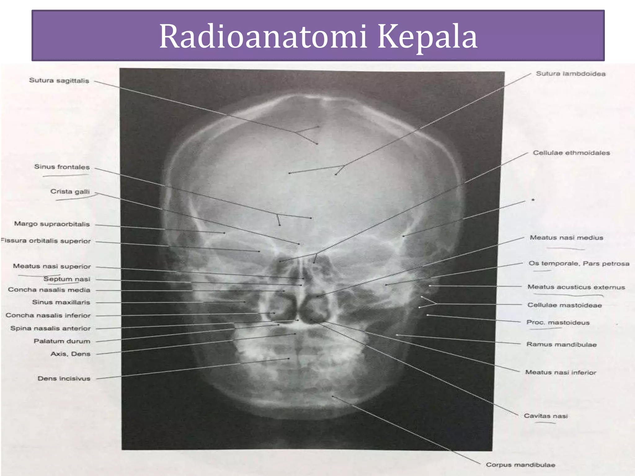 Radioanatomi (presentasi) | PPTX