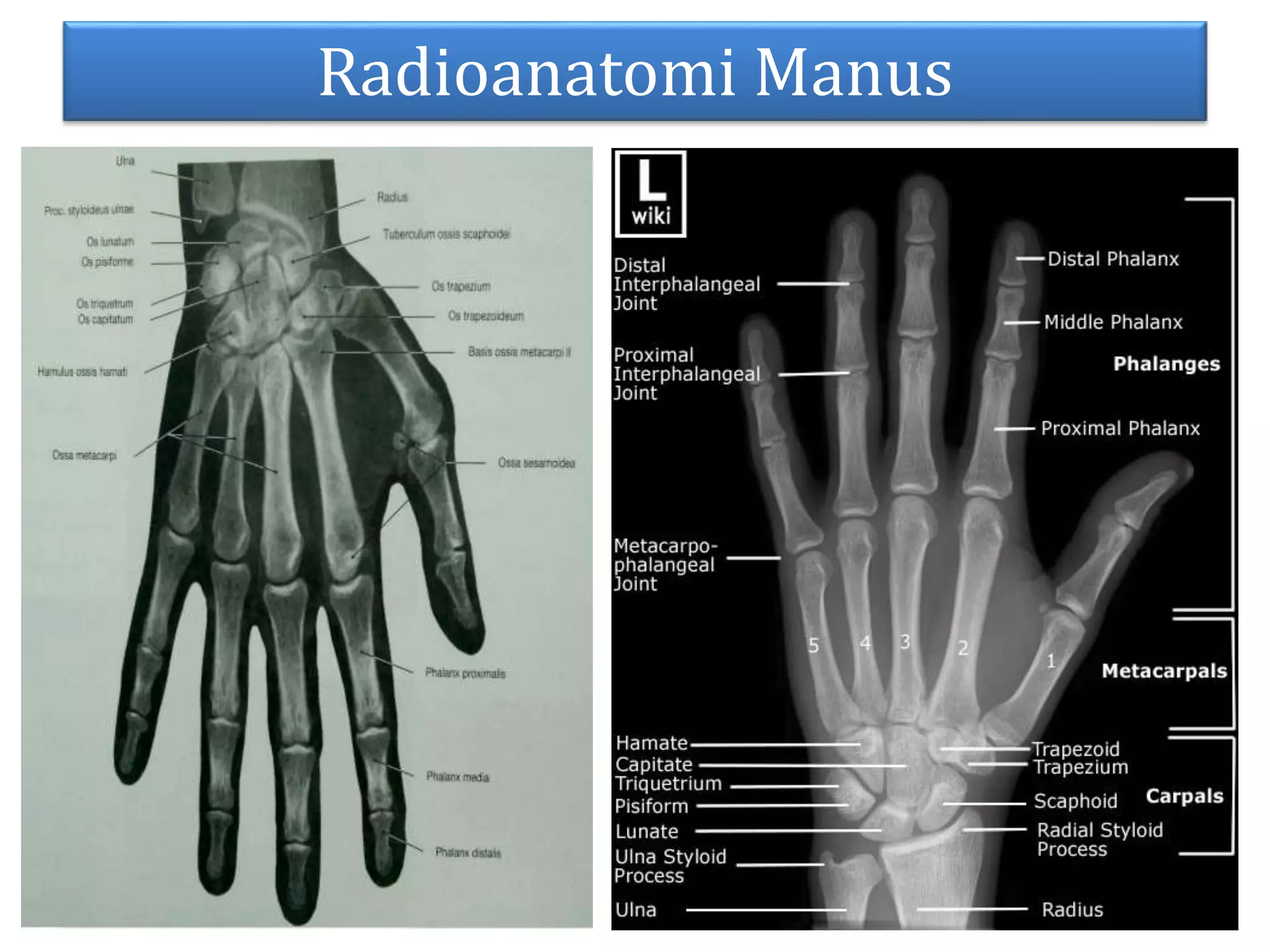 Radioanatomi (presentasi) | PPTX