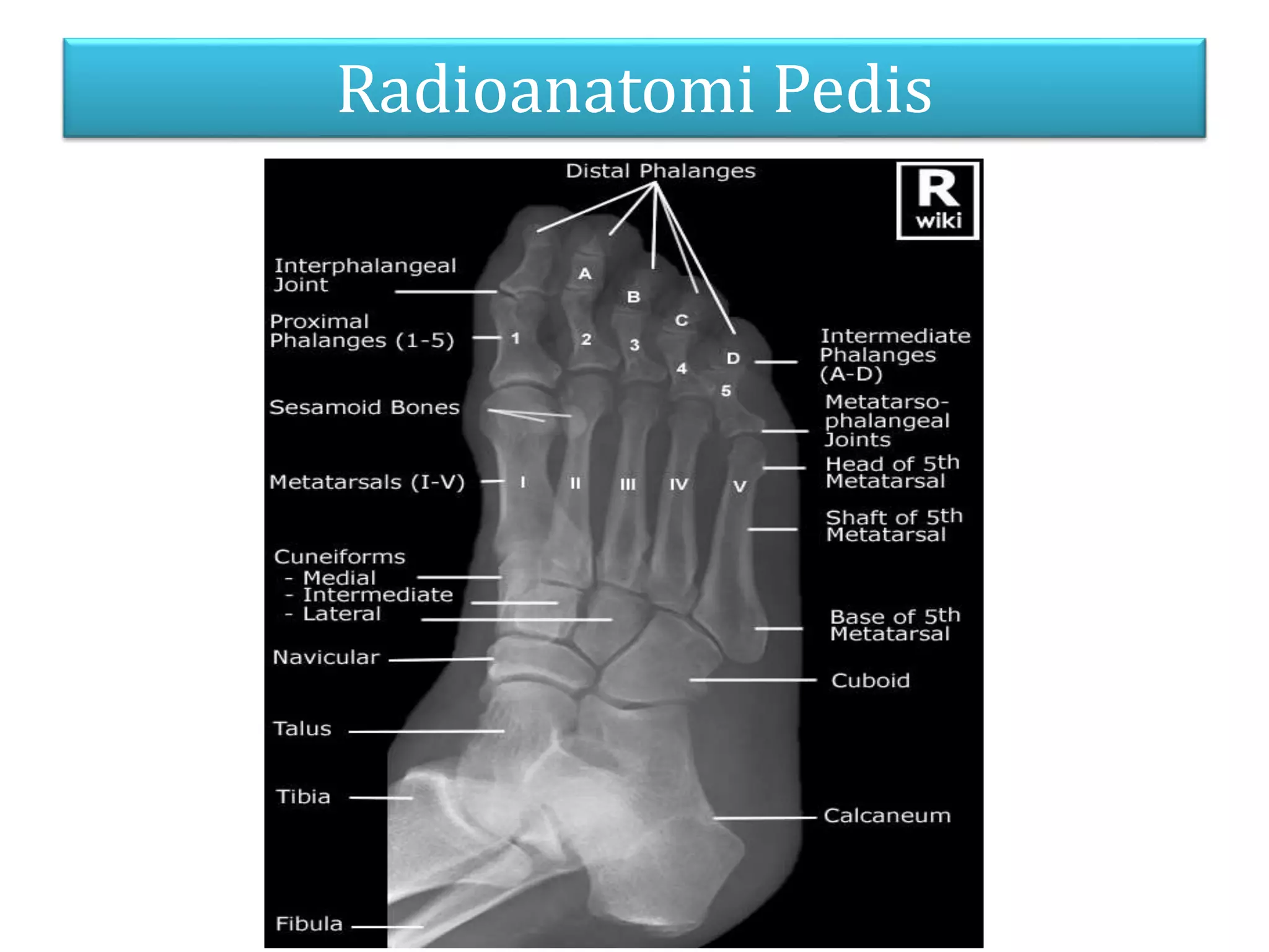 Radioanatomi (presentasi) | PPTX