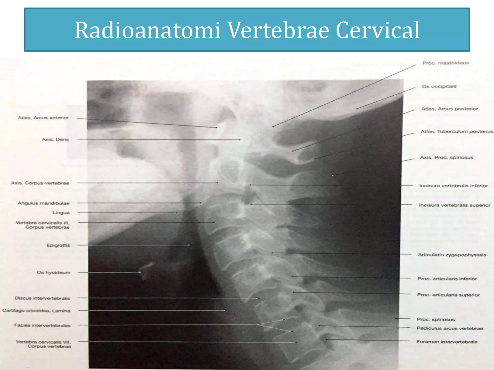 Radioanatomi (presentasi) | PPTX
