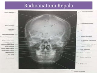 Radioanatomi (presentasi) | PPTX