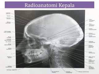 Radioanatomi (presentasi) | PPTX