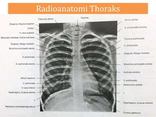 Radioanatomi (presentasi) | PPTX