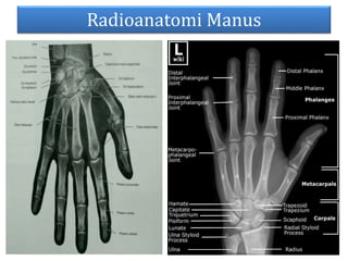 Radioanatomi (presentasi) | PPTX