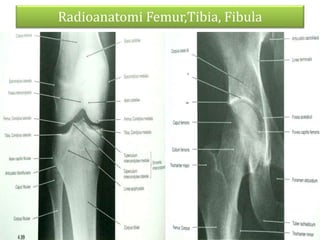 Radioanatomi (presentasi) | PPTX