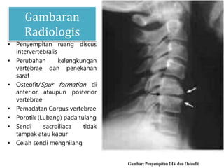 Radiologi - kelainan vertebrae | PPT