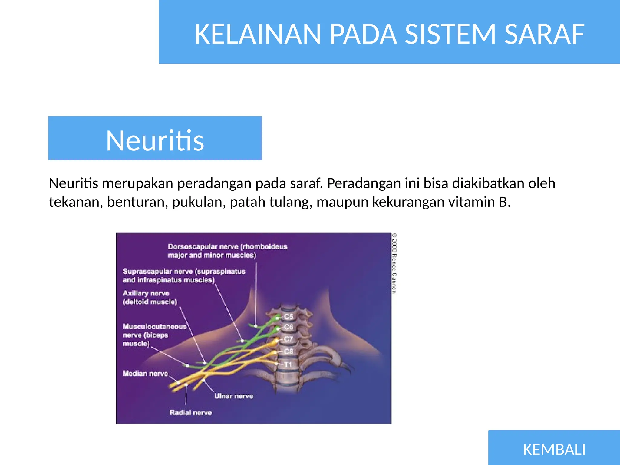 sistem saraf kelas 6 Ilmu Pengetahuan Alam dan Sosial | PPTX