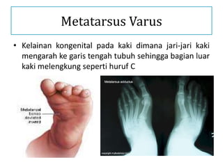 Radiologi - kelainan kongenital tulang | PPTX
