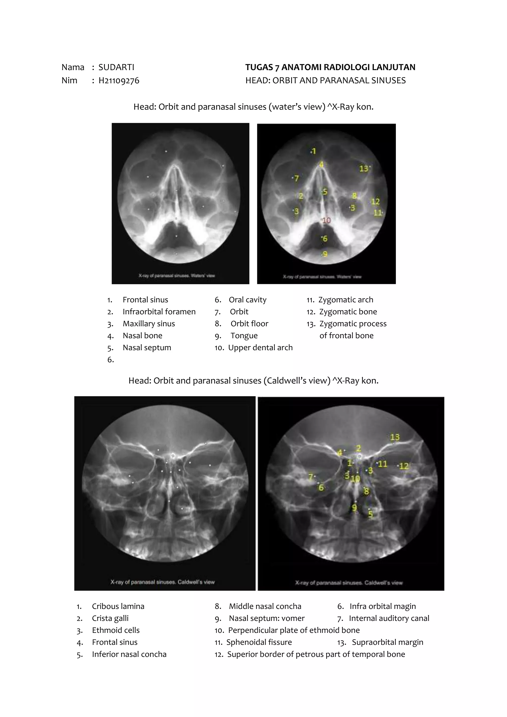 Tugas anatomi Radiologi 7 | PDF