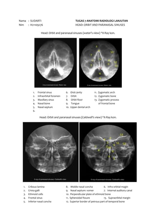 Tugas anatomi Radiologi 7 | PDF
