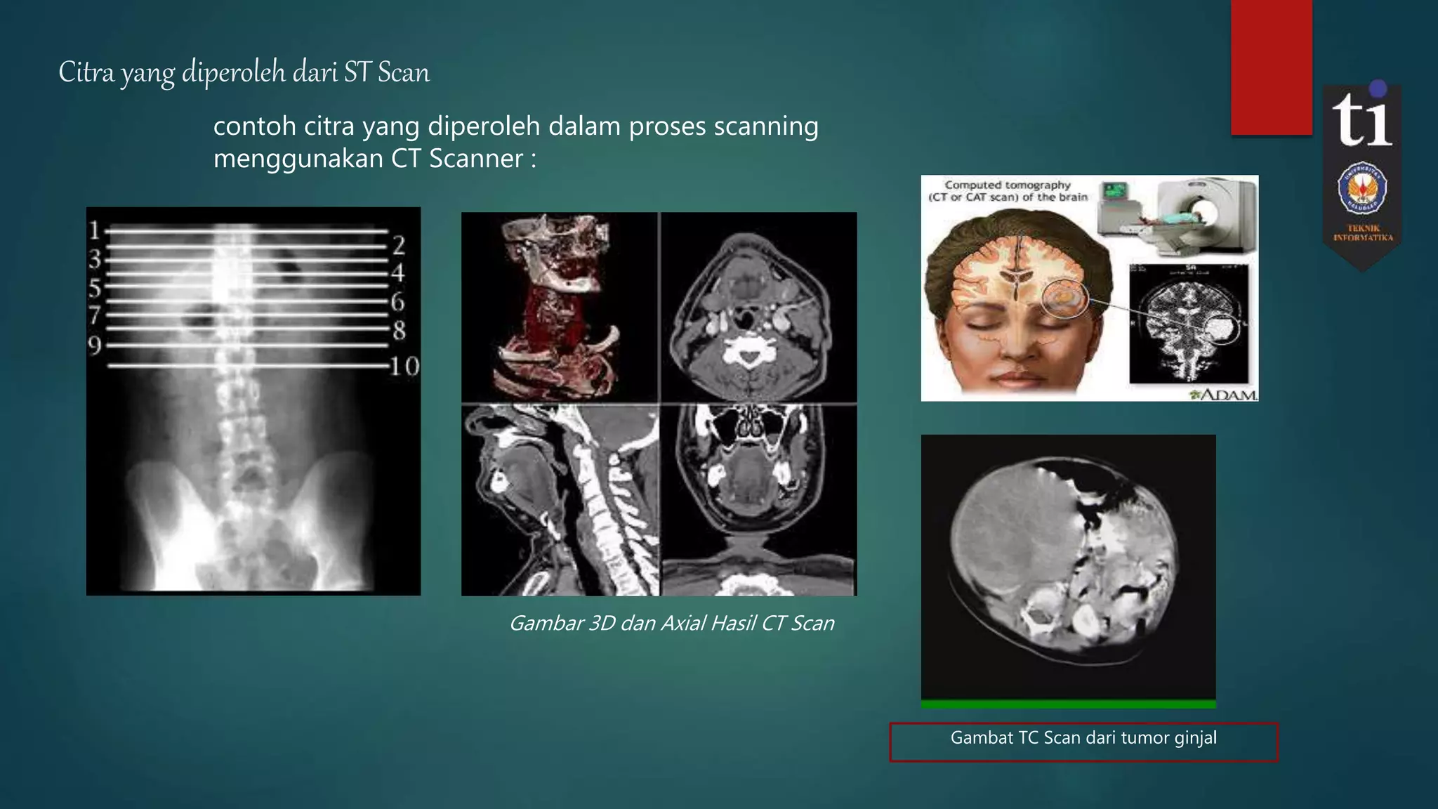 Tugas besar pti hasriana dwi dayana | PPTX