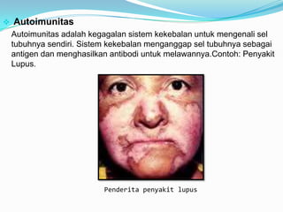 Sistem Kekebalan Tubuh Manusia | PPTX