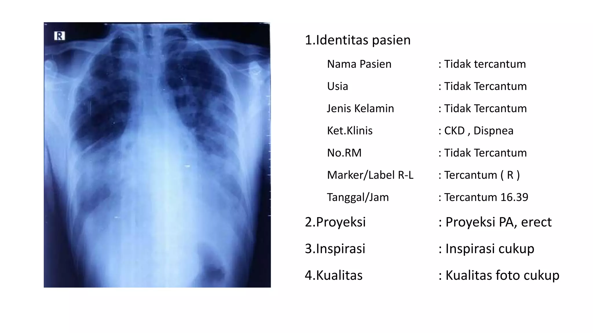 Tugas Radiologi | PPTX