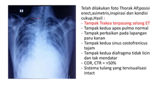 Tugas Radiologi | PPTX