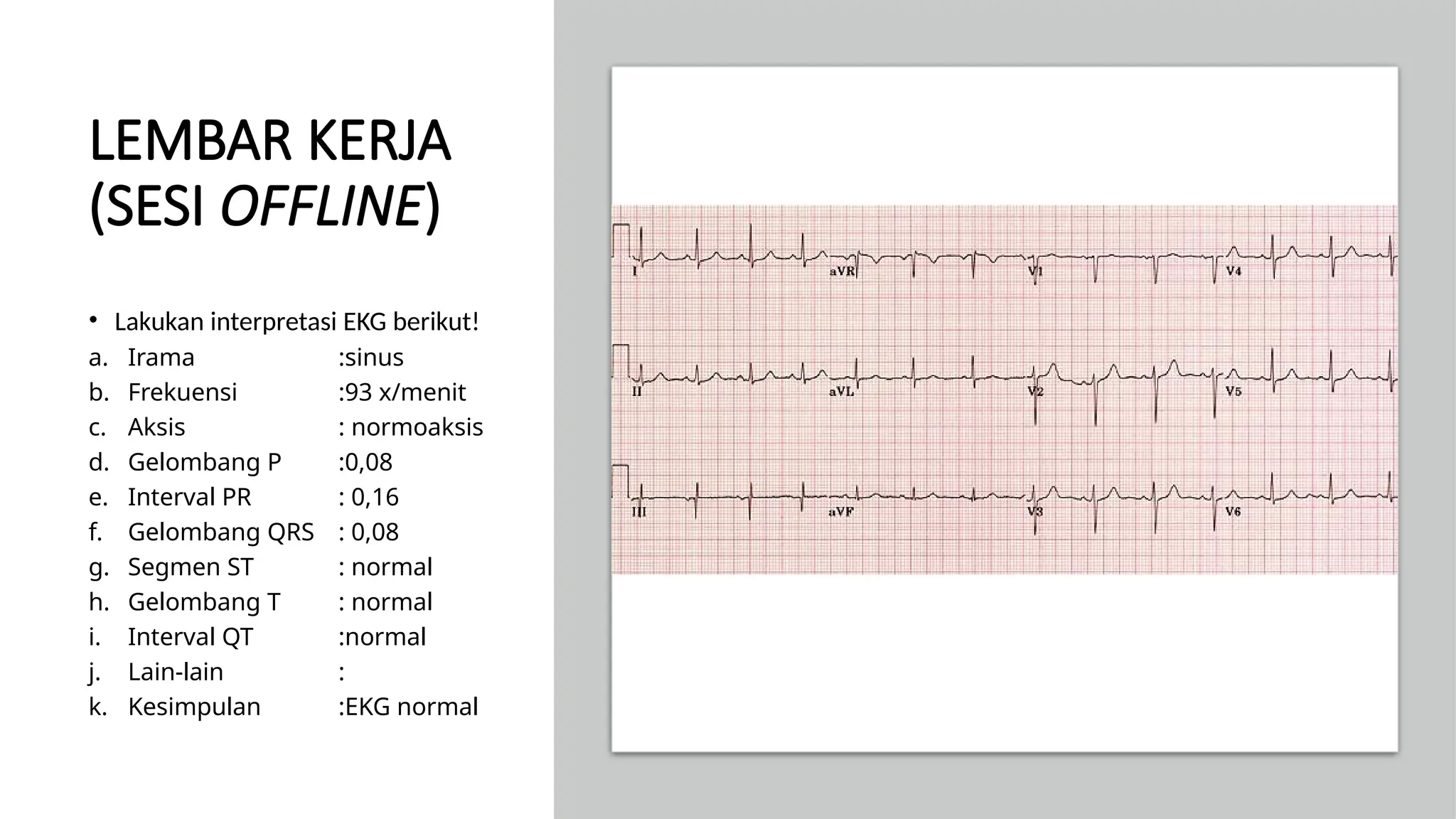 tugas membuat interpretasi gambaran EKG beserta interpretasiny | PPTX