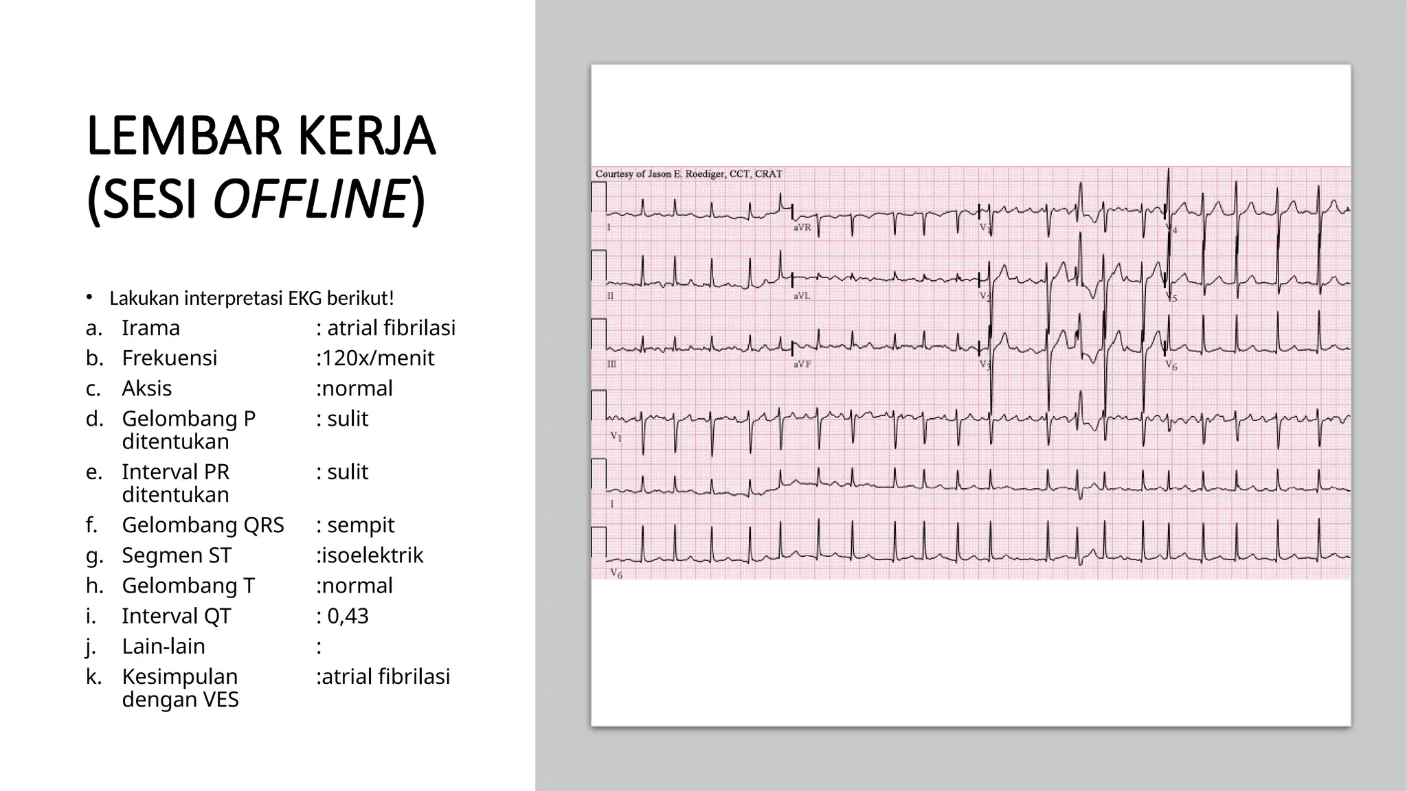 tugas membuat interpretasi gambaran EKG beserta interpretasiny | PPTX