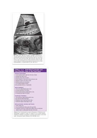 USG pada Tugas Kelainan pada Thorax 2.docx