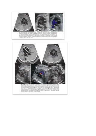 USG pada Tugas Kelainan pada Thorax 2.docx