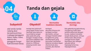 ppt kmb luka bakar dan dermatitis tugas kelompok | PPT